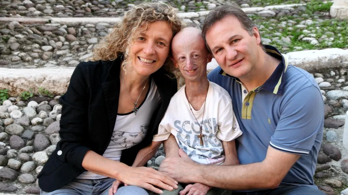 Părinții lui Sammy Basso, băiatul diagnosticat cu progeria, dezvăluiri ...